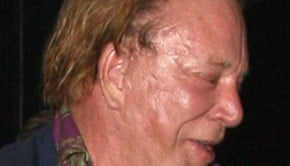 What happened to Mickey Rourke's face? - Scallywag and Vagabond