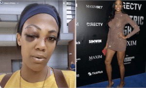 Kim Glass ex Olympic volleyball player beaten by homeless man with pipe