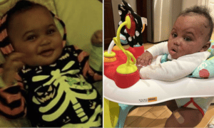 Semaj 7 month old DC baby mauled by pit bulls left brain damaged