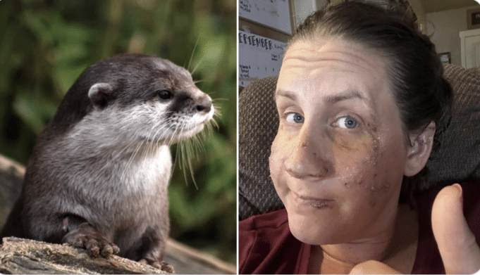 Jen Royce otter attack: Montana woman tubing outing nearly lethal