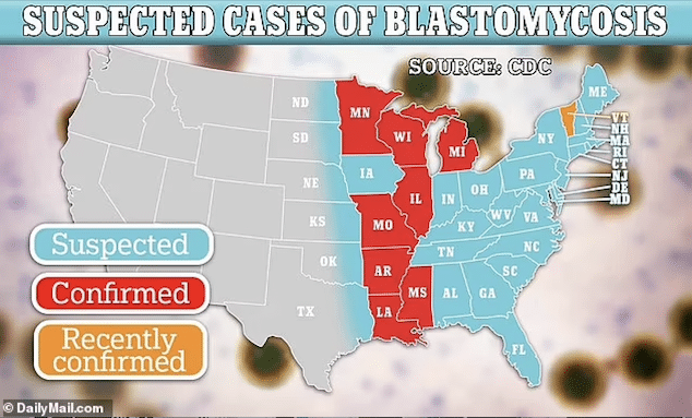 Ian Pritchard, Michigan Chef, dies catching rare fungal infection