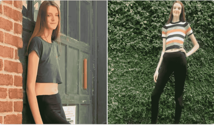 Texas woman with longest legs in the world explains how she dates