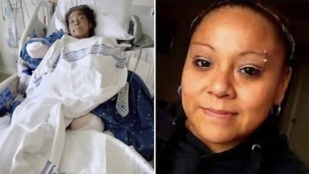 Janelle Scott loses all 4 limbs in dog attack after pit bulls escaping ...